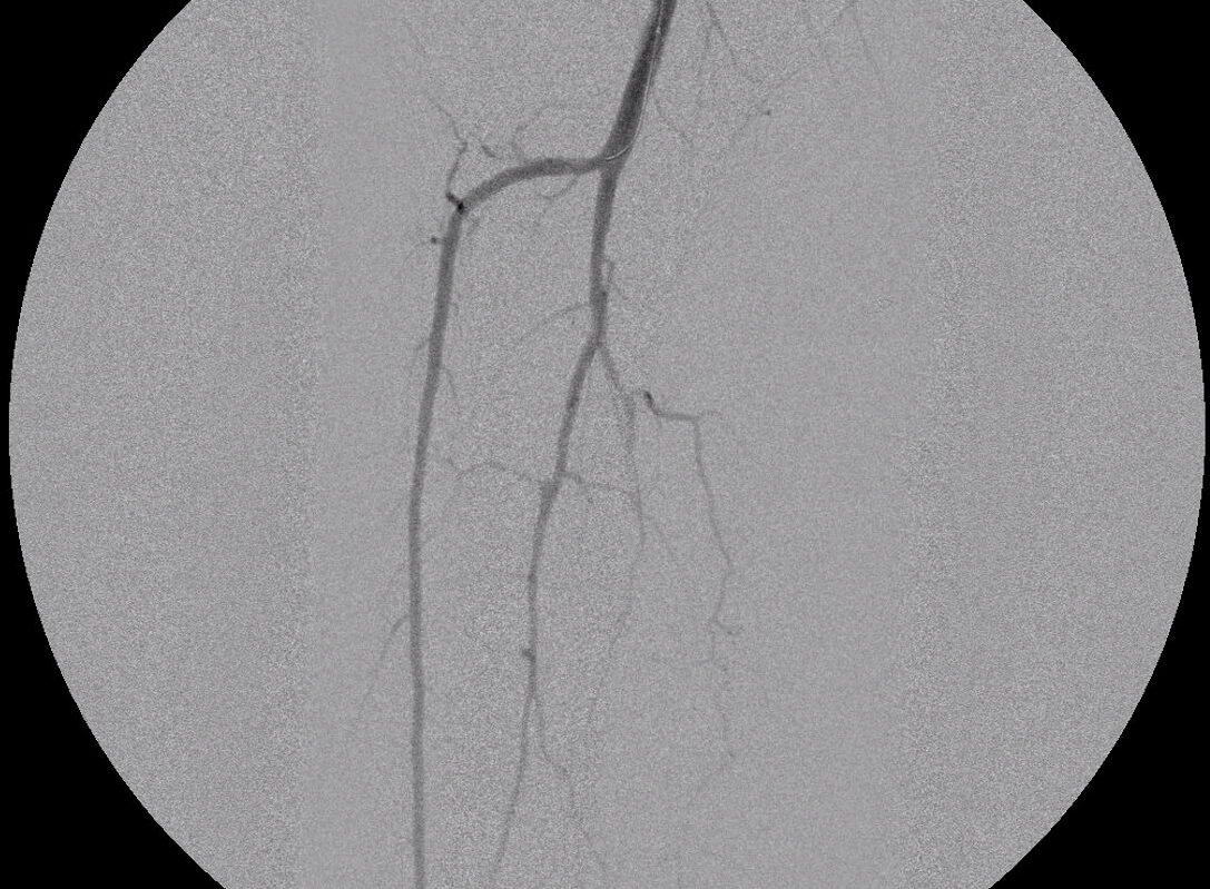 Home - Summa Therapeutics, LLC